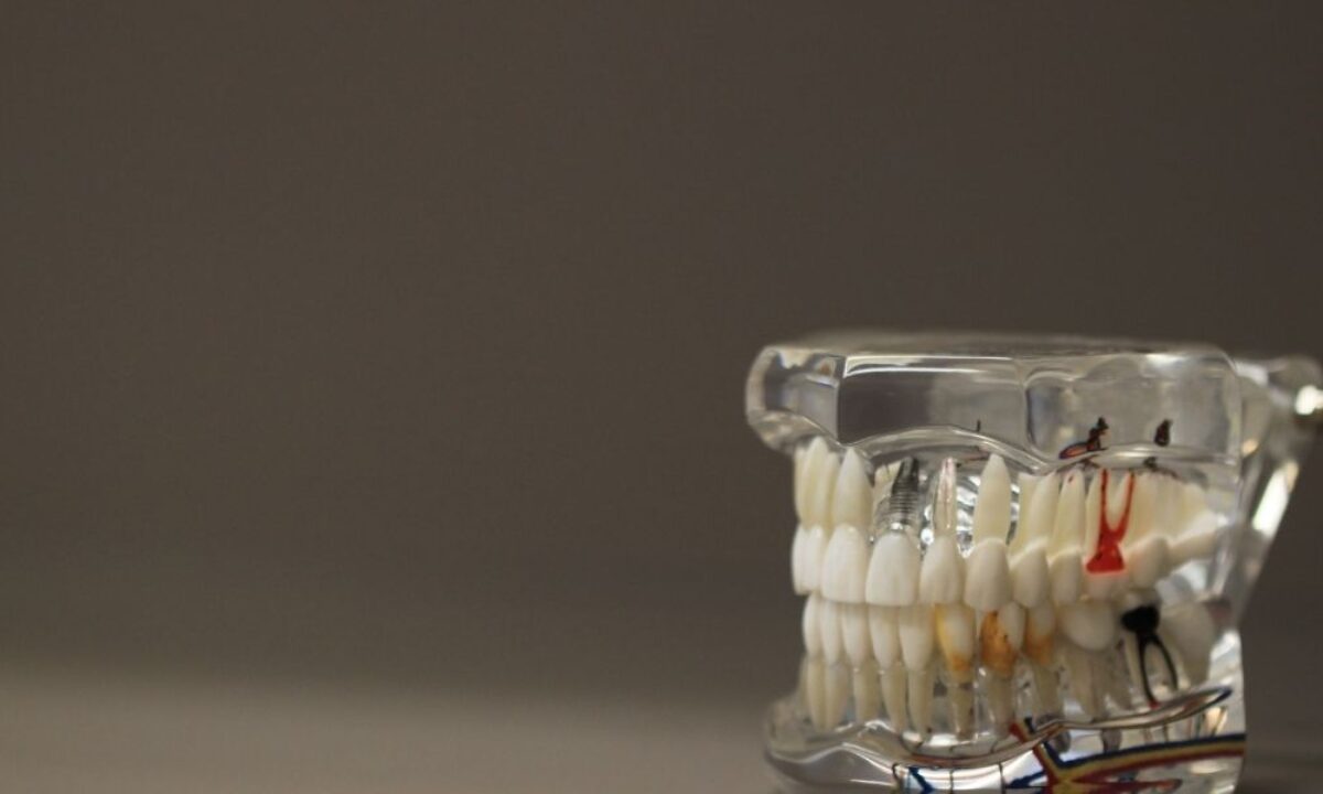 Rotten Back Teeth